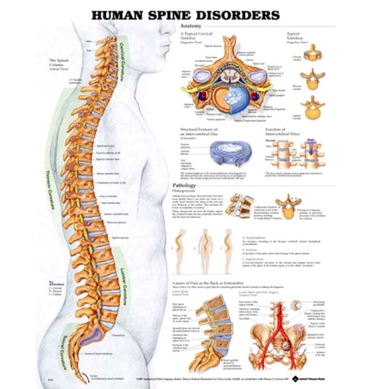 Styrene Human Spine Disorders Chart | SME, Inc. USA