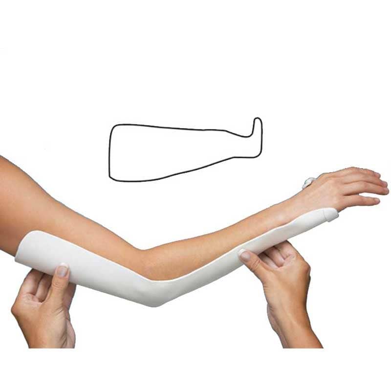 Splint arm store
